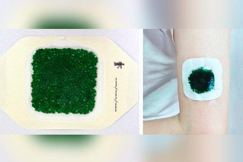 Microalgae-gel patch to promote chronic wound healing in diabetics ...