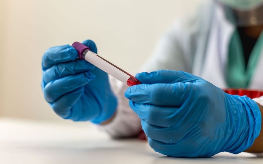 Scientists succeed in synthesising promising anti-cancer fungal compound